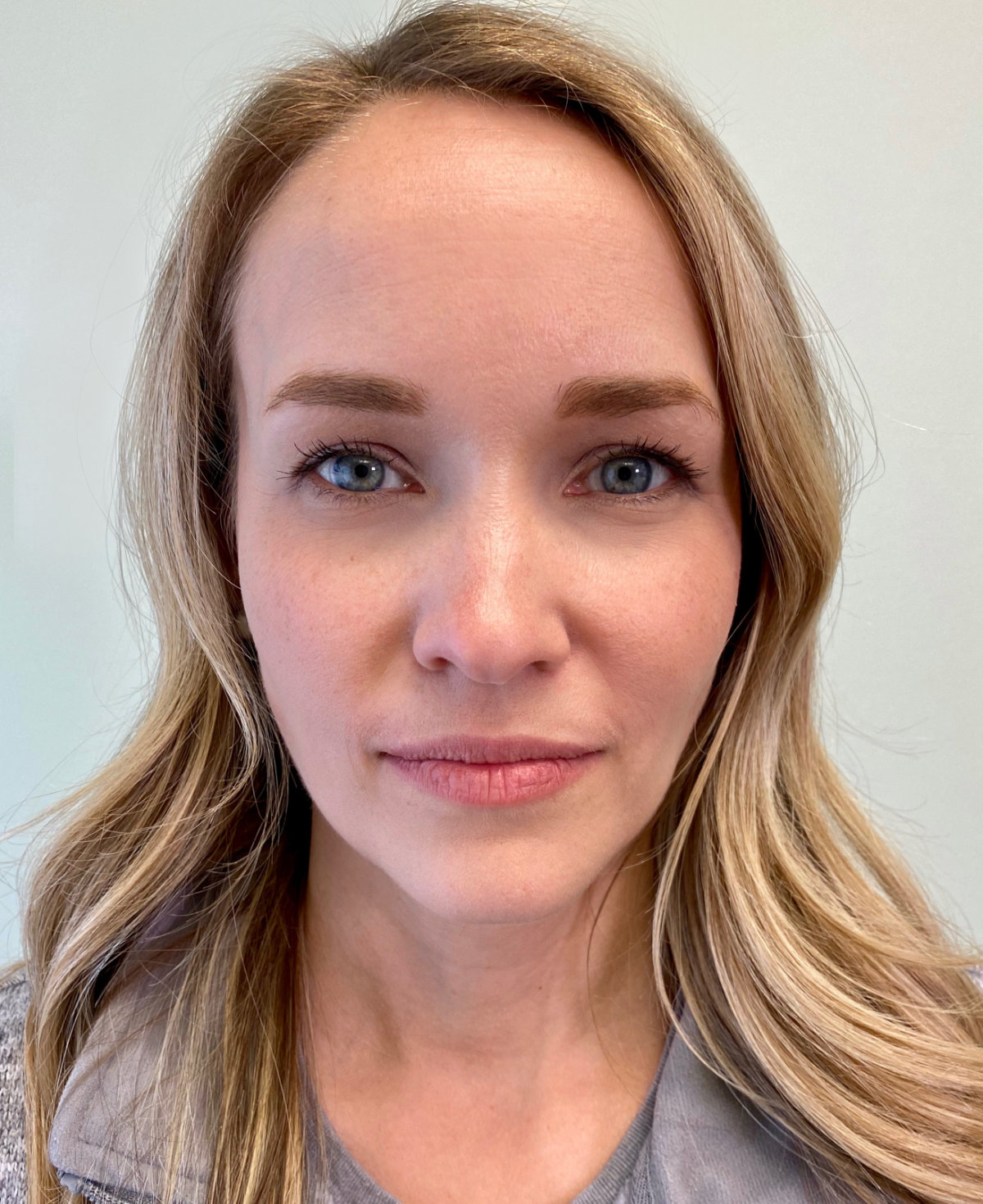 Virtual Smile Assessment - Farnsworth Family Orthodontics