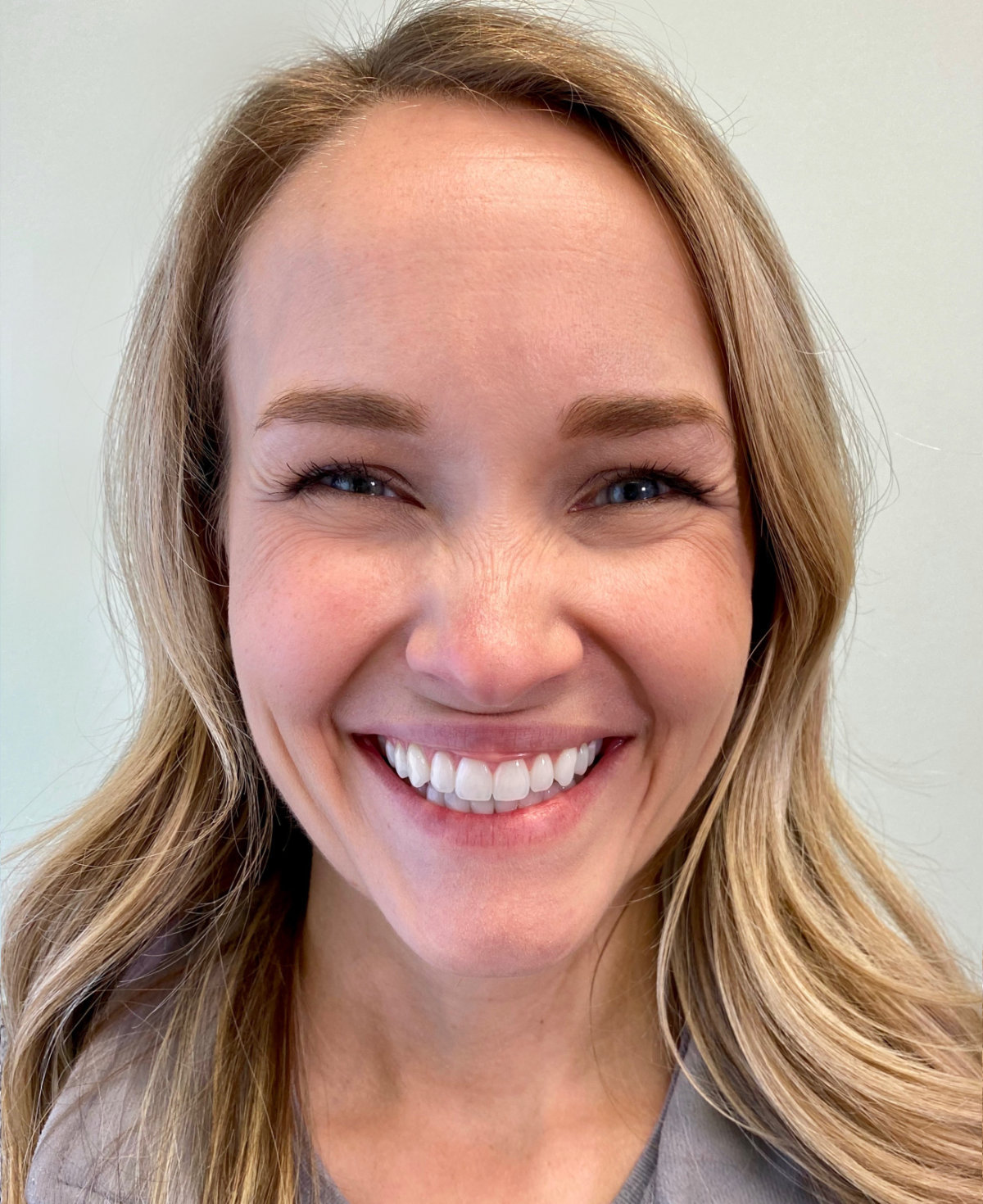 Virtual Smile Assessment - Farnsworth Family Orthodontics