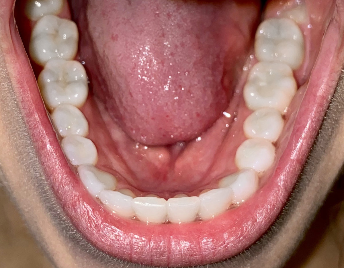 Virtual Smile Assessment - Farnsworth Family Orthodontics